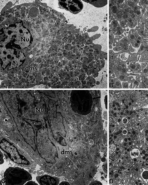 Transmission Electron Micrographs Of Representative Megakaryocytes And Download Scientific