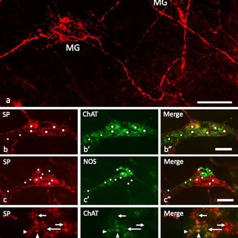 Wholemount Preparations Of The Myenteric Plexus In The Rat Esophagus Download Scientific