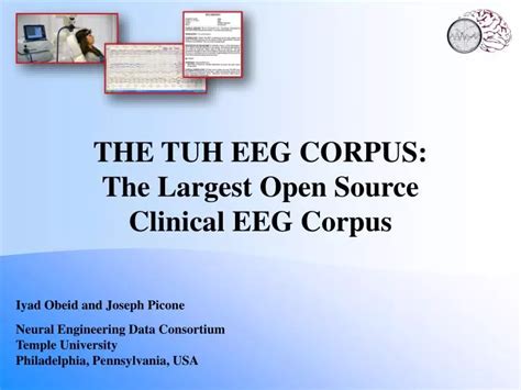 Ppt The Tuh Eeg Corpus The Largest Open Source Clinical Eeg Corpus Powerpoint Presentation