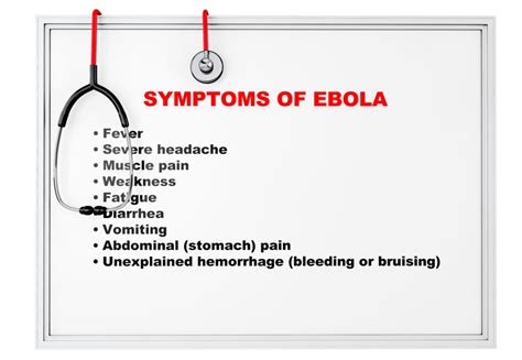 Rare Sudan Ebolavirus Outbreak Nadcc Tablet