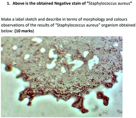 Above Is The Obtained Negative Stain Of Staphylococcus Aureus Make A