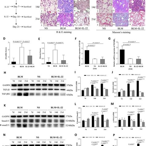 Elevated Bleomycin Blm ‐induced Inflammation And Fibrosis In Download Scientific Diagram