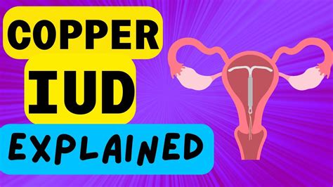 Copper Iud Insertion On Period At Kristy Breeden Blog
