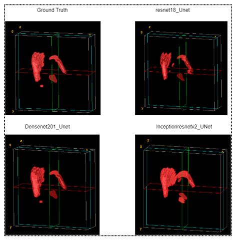 Diagnostics Free Full Text A Deep Learning Based Automatic Segmentation And 3d Visualization