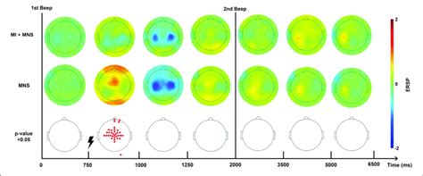 Topographic Map Of Erders Grand Average N 16 In The