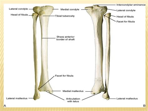 SOLUTION Tibia And Fibula Studypool SOLUTION Tibia And Fibula Studypool