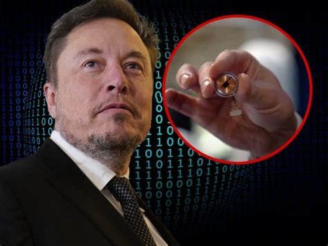 Elon Musk Says Neuralink Implants Brain Chip In First Human Subject
