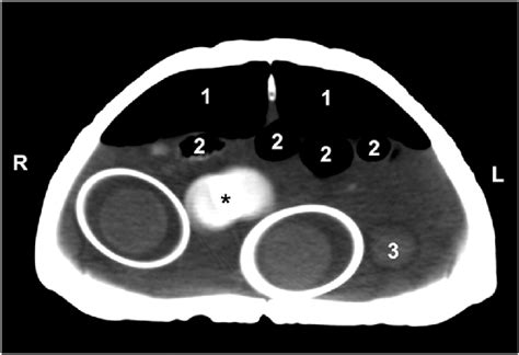 Computed Tomography Image Of The Middle Body Of A Greek Tortoise