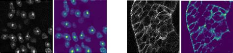 figure 1 from self supervised deep learning for fluorescence microscopy