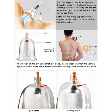 Acupuncture Cupping Therapy Set Unlock Healing 2 Top Sets
