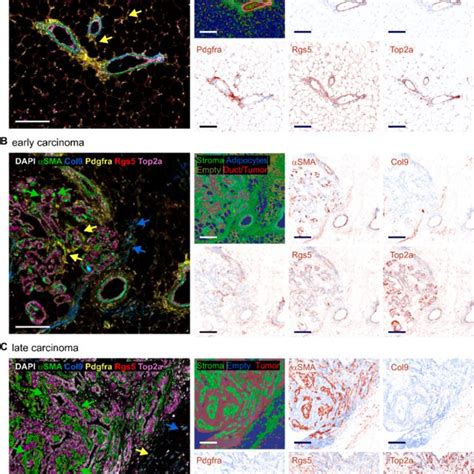 Histology Of Cancer Associated Fibroblast Caf Subset Marker Download Scientific Diagram
