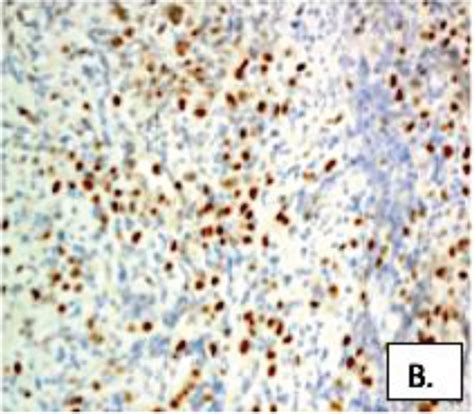 Histologic Stains Demonstrating Hematoxylin And Eosin Stain Of Penile