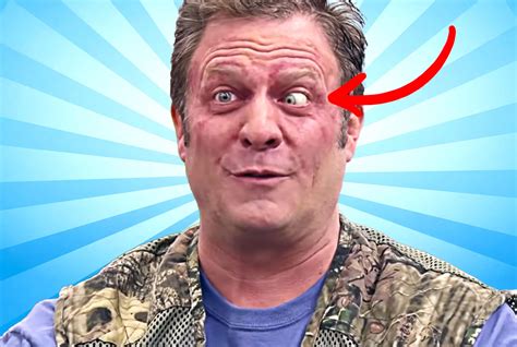 The Truth About Jonathan Loughrans Lazy Eye Does He Have Strabismus