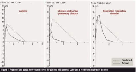 How To Interpret Spirometry Readings The Pharmaceutical Journal
