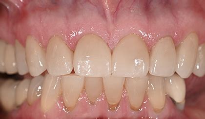 Dentist In Mesa Az Brown Road Dental