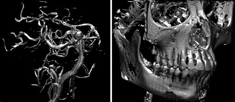 Two Rendered Results Of The MC Implementation Download Scientific Diagram