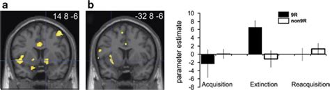 Ventral Striatal Vs Prediction Error Signaling During Extinction A