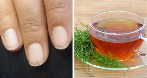 10 Home Remedies That Can Do Wonders For Your Nails