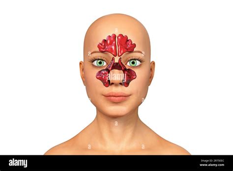 Human Sinuses Computer Illustration The Sinuses Are Membrane Lined