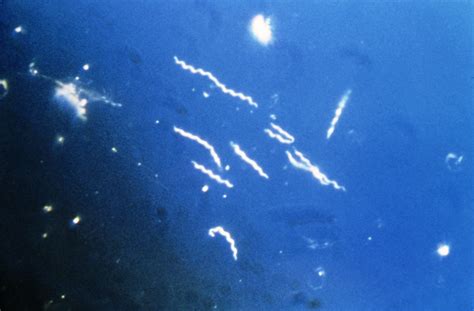 75 Examples Of Bacterial Motility Biology Libretexts