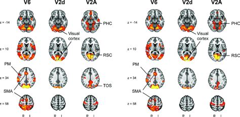 seed based partial correlation analysis results for v6 v2d and v2a
