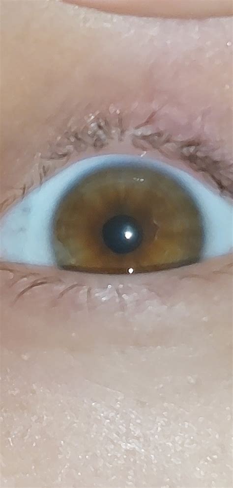 Hazel Or Heterochromia Reyes