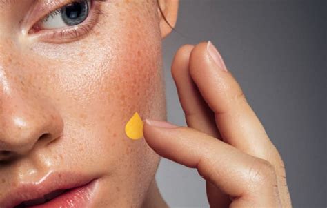 Eco Friendly Pimple Patches A Revolution In Sustainable Skincare Ruut Goods