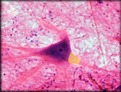 Biol 323 Lab 1 Nervous Tissue Flashcards Quizlet