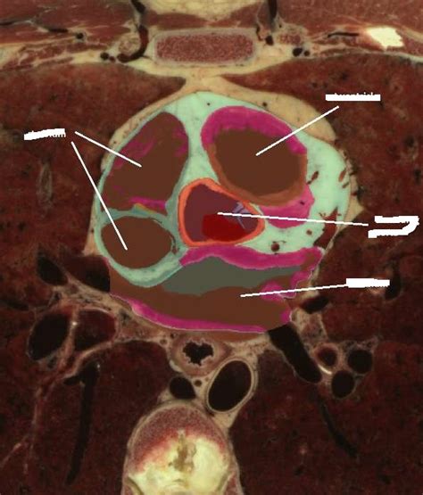 Cad 16 Diagram Quizlet