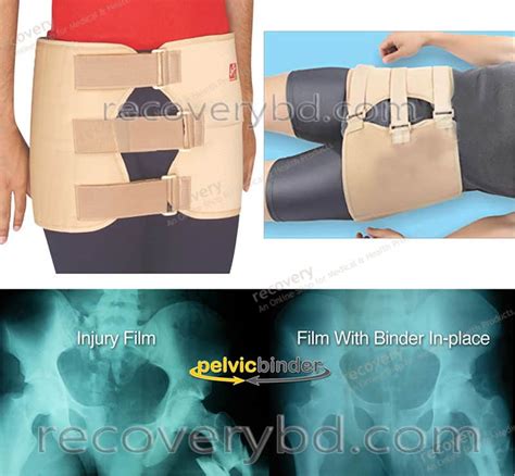 Pelvic Binder Pelvic Wrap Pelvic Fastener