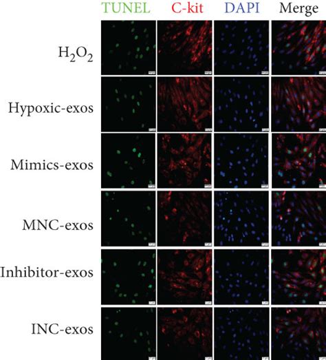 Exosomes Derived From Mir 214 Modified Bmscs Exert An Antiapoptotic Download Scientific Diagram
