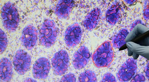 High Precision Laser Microdissection System