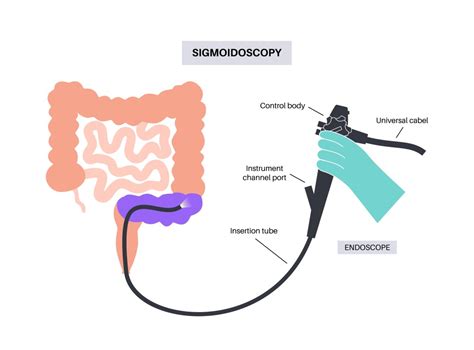 Sigmoidoscopy Trivenigastrocare