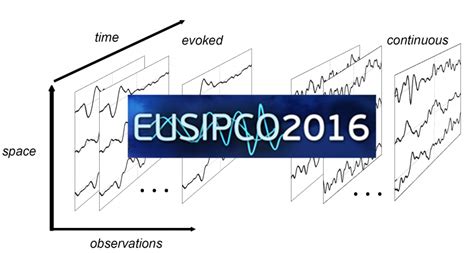 Eusipco16 Presenting Composite Approximate Joint Diagonalization • Louis Korczowski Phd
