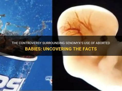 The Controversy Surrounding Senomyxs Use Of Aborted Babies Uncovering