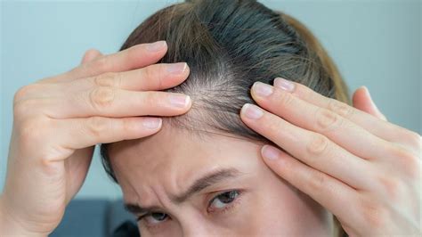 Hair Loss Expert Names The Trendy Hairstyle Causing Women To Go Bald