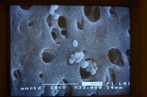 Op Selection For Pmt Preamp On Scanning Electron Microscope Page 1