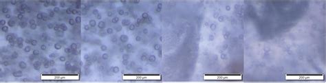 Inverted Microscope Image Of Polystyrene Microemulsion By Using Brij R