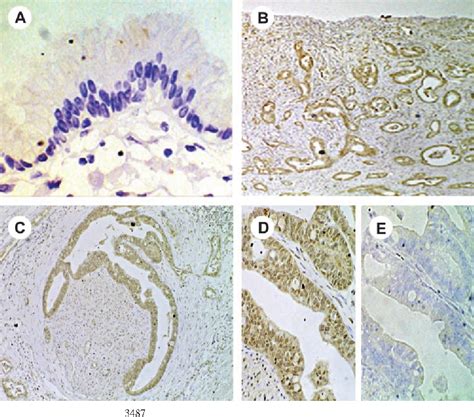 Follicular Atrophoderma And Basal Cell Epitheliomata Semantic Scholar