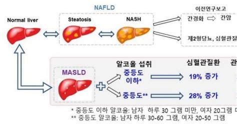 대사이상 지방간 질환자 알코올 섭취 시 심혈관질환 위험↑