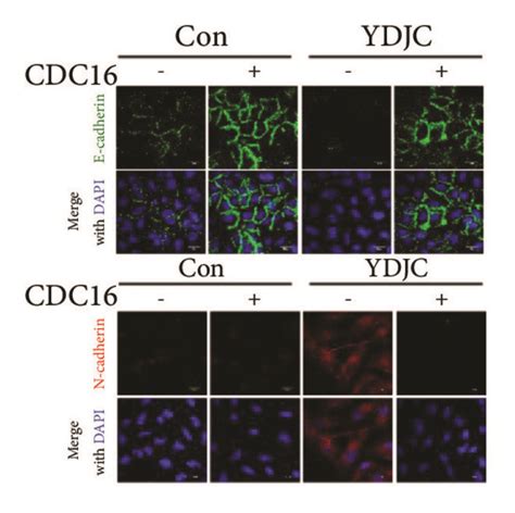 Cdc16 Regulates Emt A Effect Of Cdc16 Overexpression On Spc Induced
