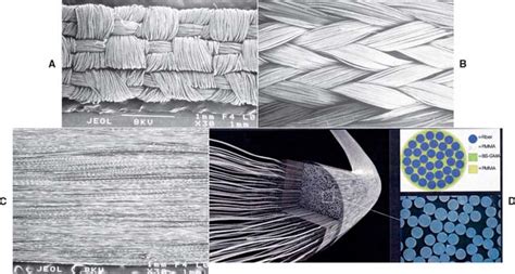 27 Fiber Reinforced Composite Fixed Prostheses Pocket Dentistry