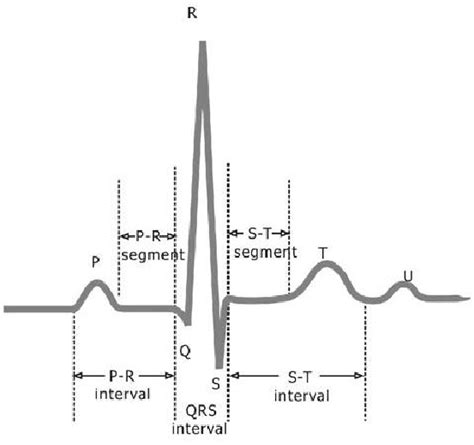Time Domain Diagram Of Ecg Signal In The Time Domain Diagram Of The