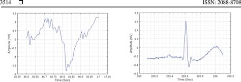 Figure 1 From Detection Of Electrocardiogram Qrs Complex Based On Modified Adaptive Threshold