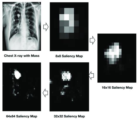 illustration of cxr with saliency maps of increasing resolutions