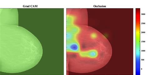 heatmaps generated by grad cam and occlusion sensitivity explainable ai