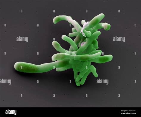Corynebacterium Diphtheriae Bacteria Coloured Scanning Electron Micrograph Sem