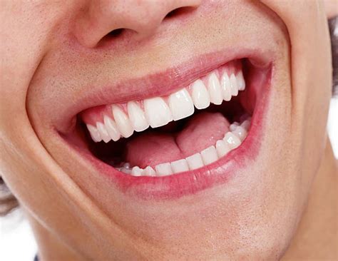 Open Mouth Teeth