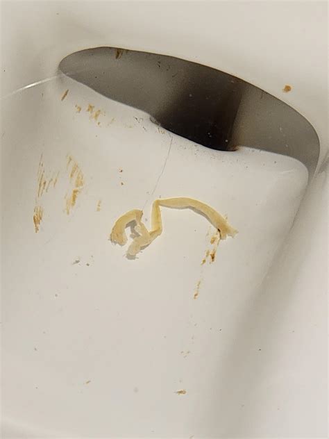 Tapeworm In Human Stool