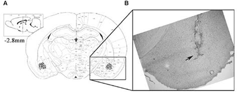 The Location Of The Amygdala Basolateral Amygdala Bla Placement Of